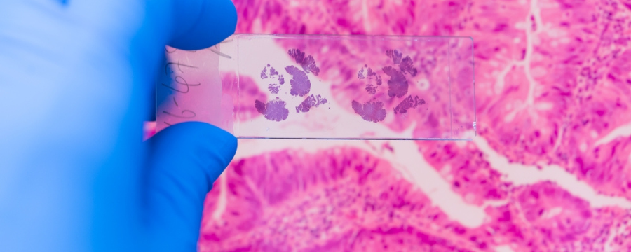 SEOM - Sociedad Española de Oncología Médica